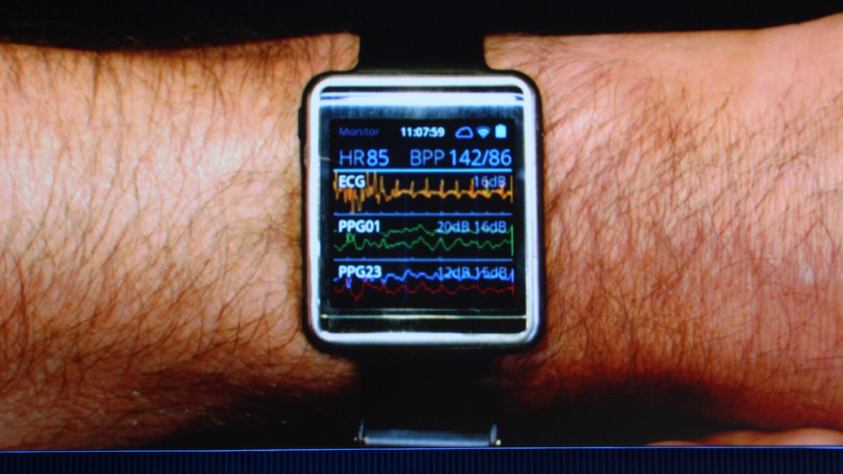 Samsung Simband: what you need to know | TechRadar