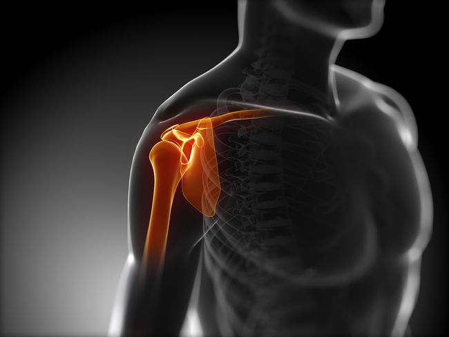 How Can Common Shoulder Problems Be Treated? | Live Science