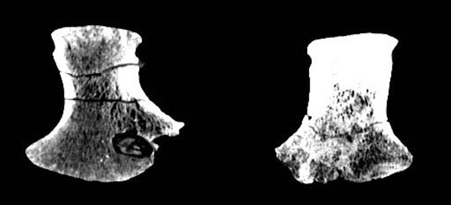 Clumsy Dinosaur or Attack Survivor? Injuries Plagued Ancient Beast ...