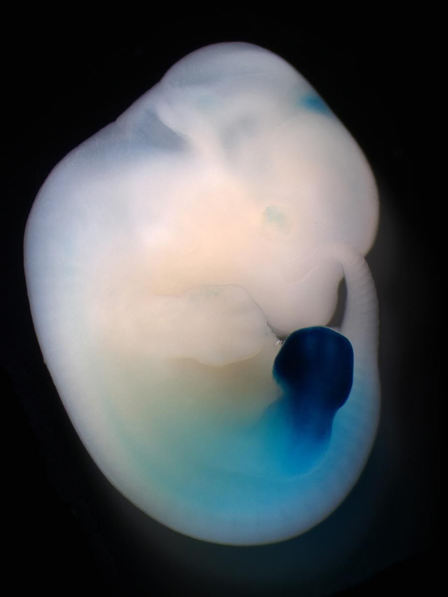 In Photos: How Snake Embryos Grow a Phallus | Live Science