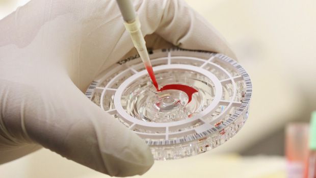 Ebola virus mutation may be more contagious | The Week