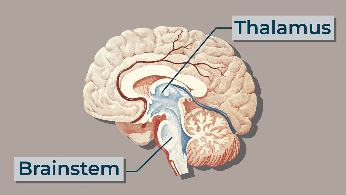 How much of your brain do you need to survive? | Live Science