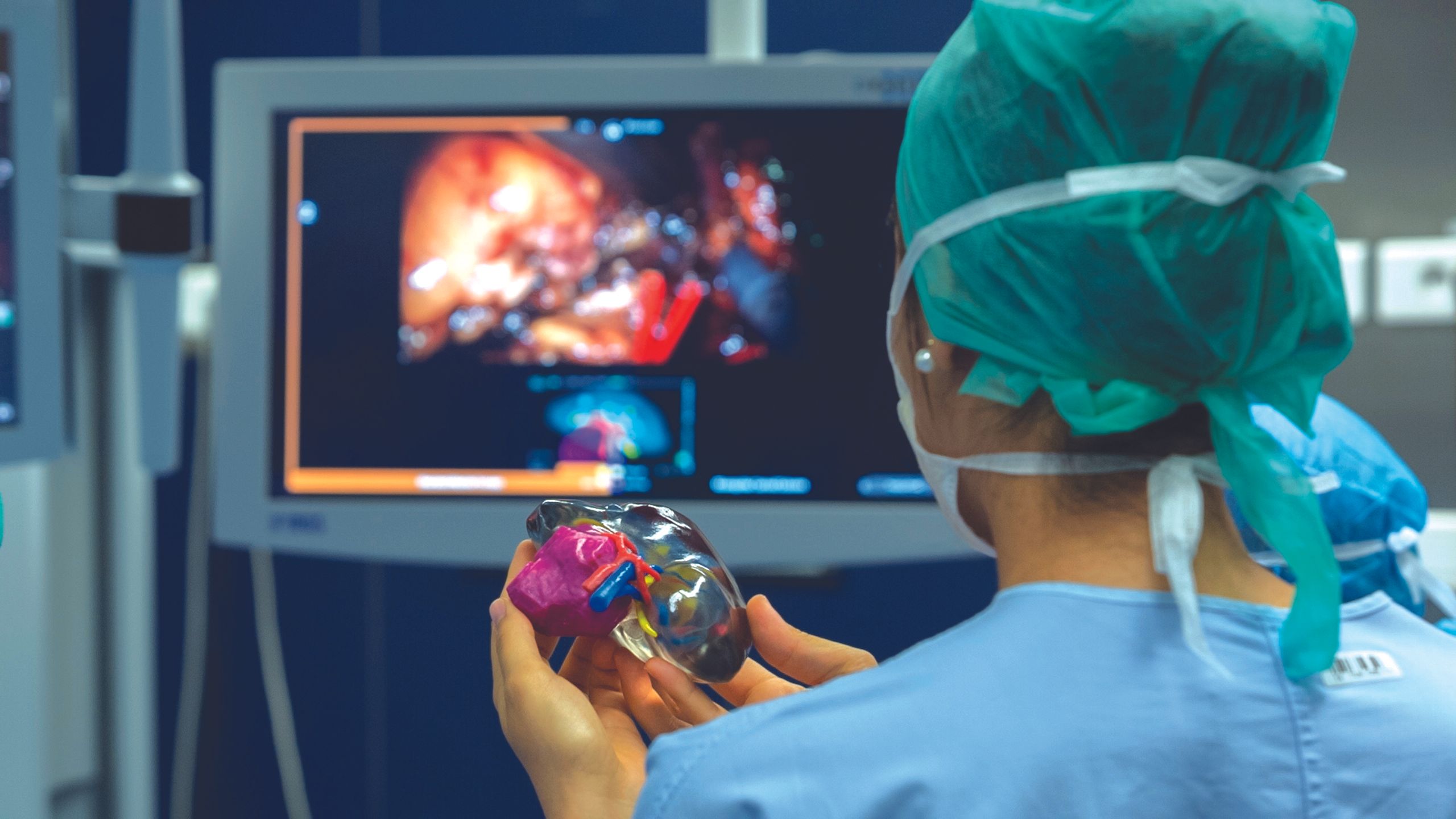 Whatever Happened To The 3d Printing Revolution It Pro