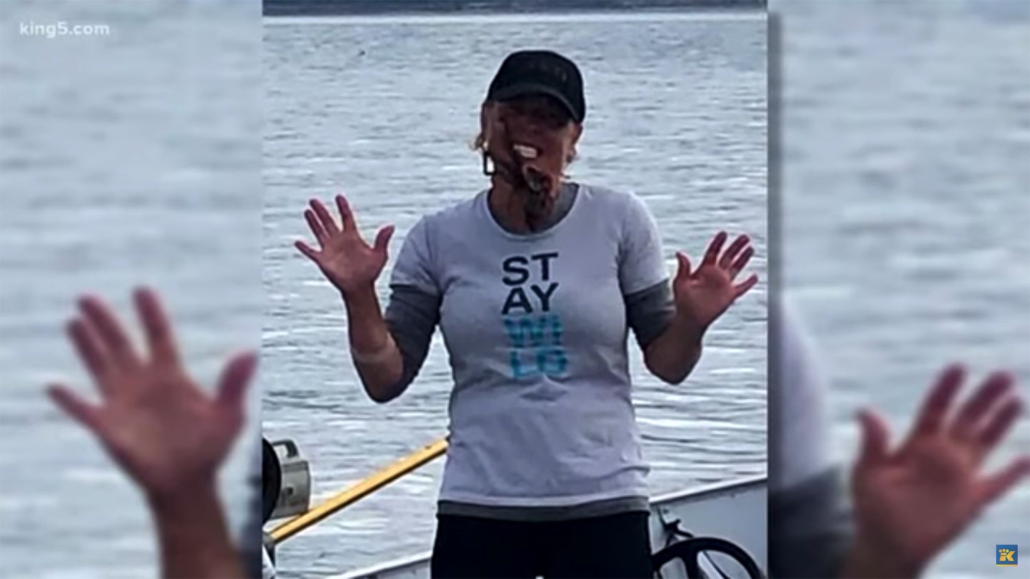 A Woman Placed an Octopus on Her Face for a Photo. Then It Bit Her ...