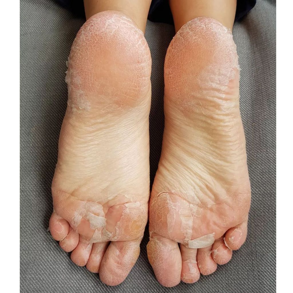 4 best exfoliating socks for super-soft feet, tried and tested | Marie ...