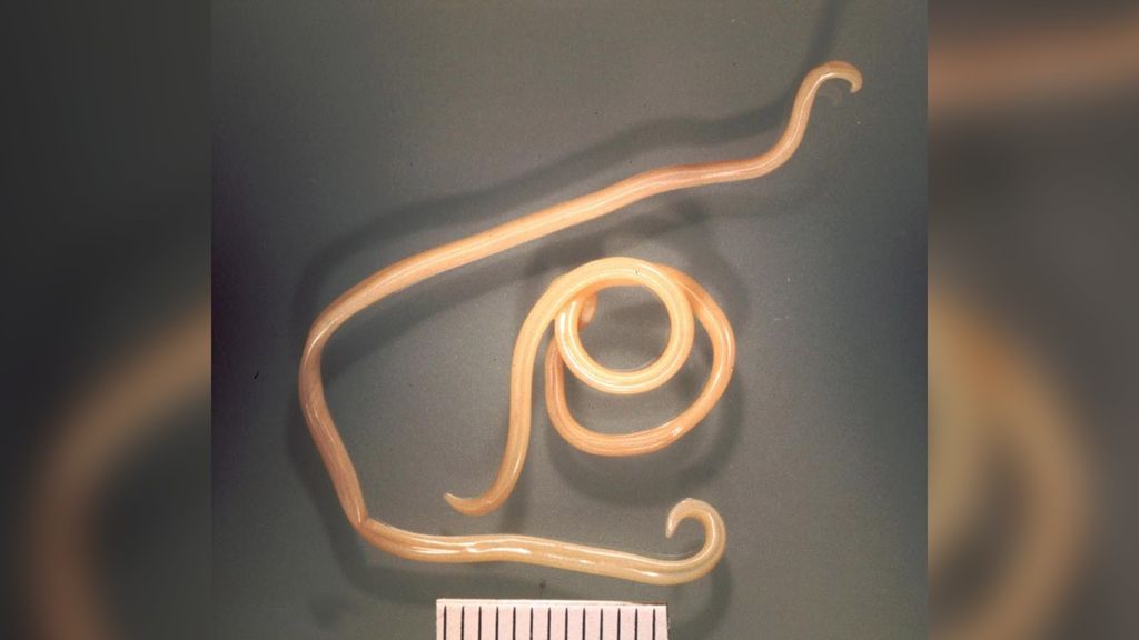 32 scary parasitic diseases | Live Science