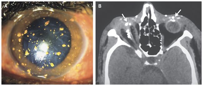 13 horrific firework injuries that will keep you cautious on July 4 ...