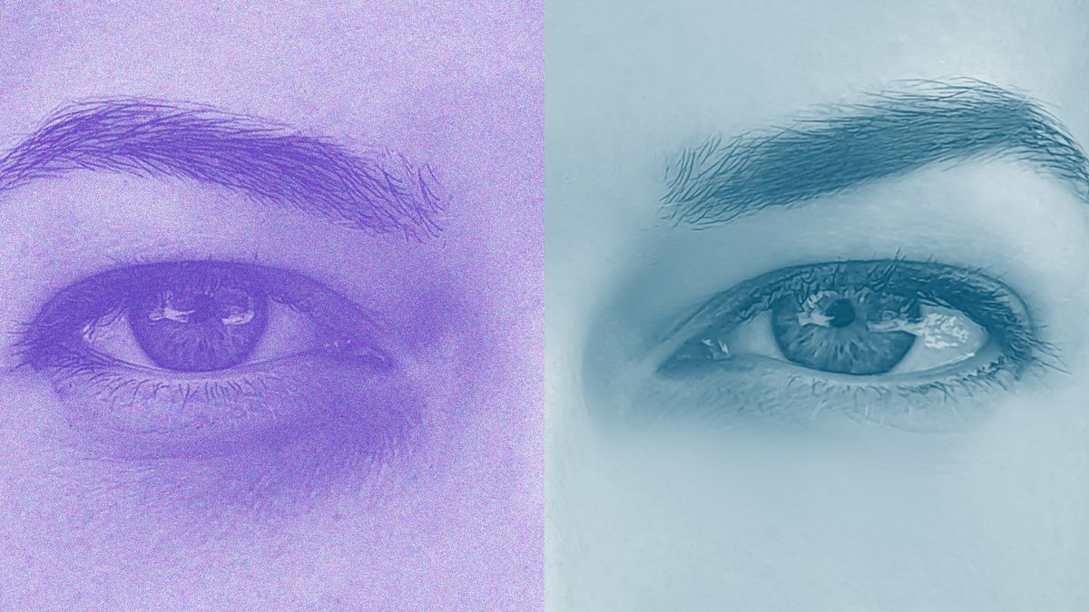 Under-Eye Filler 101: Everything to Know Before Injections | Marie Claire