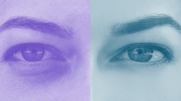 Under-Eye Filler 101: Everything to Know Before Injections | Marie Claire