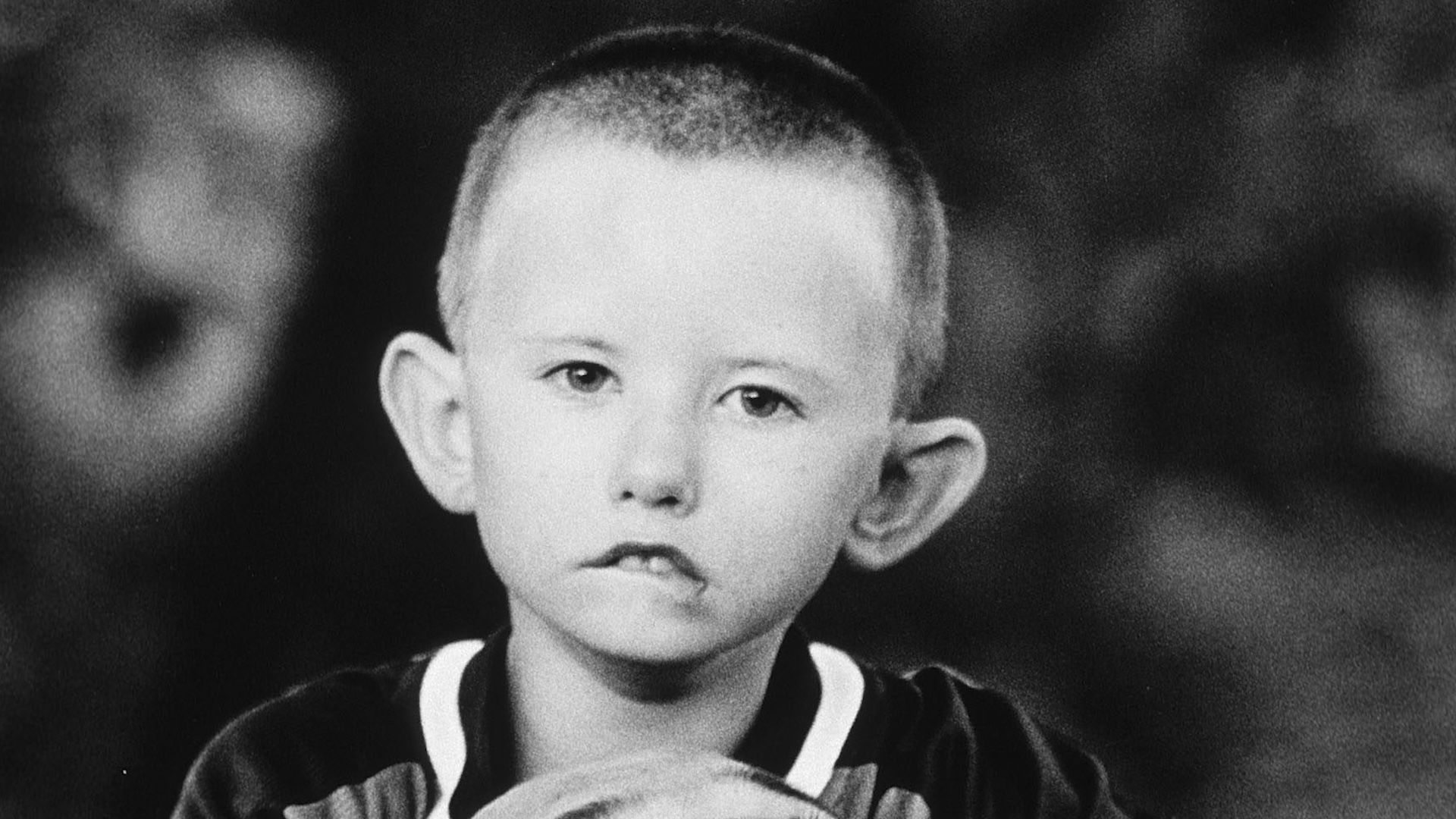 Moebius syndrome: The rare condition that makes people unable to smile ...