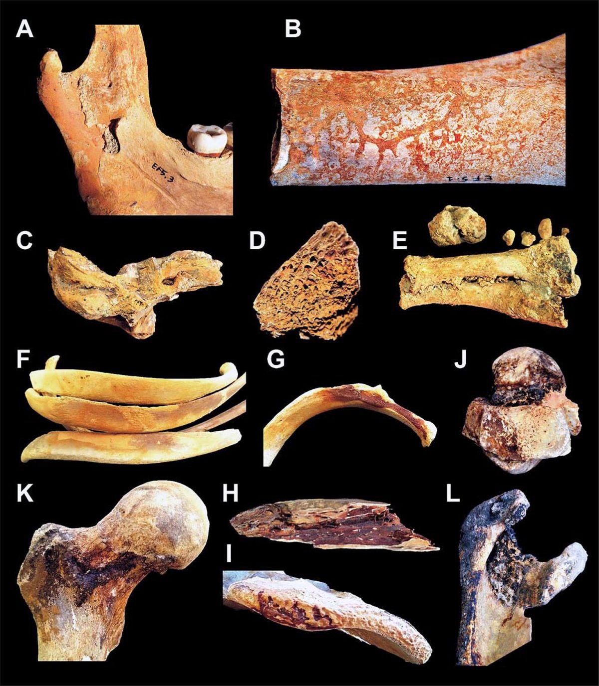 Photos: The Bones of Mount Vesuvius | Live Science