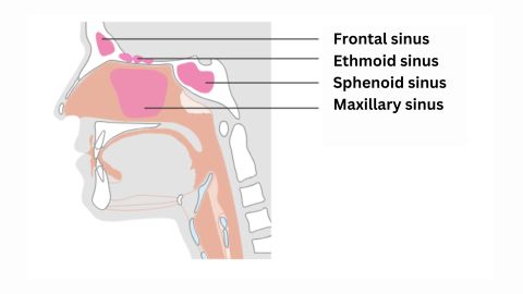 What does it look like when your sinuses are clogged? | Live Science