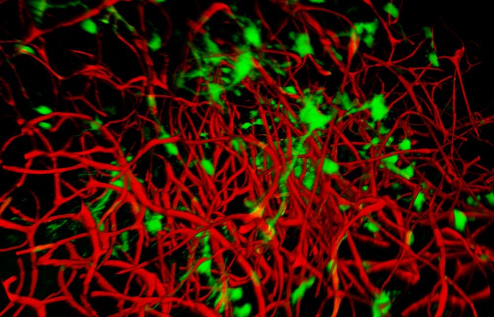 See-Through Brain Reveals How Cells Connect | Live Science