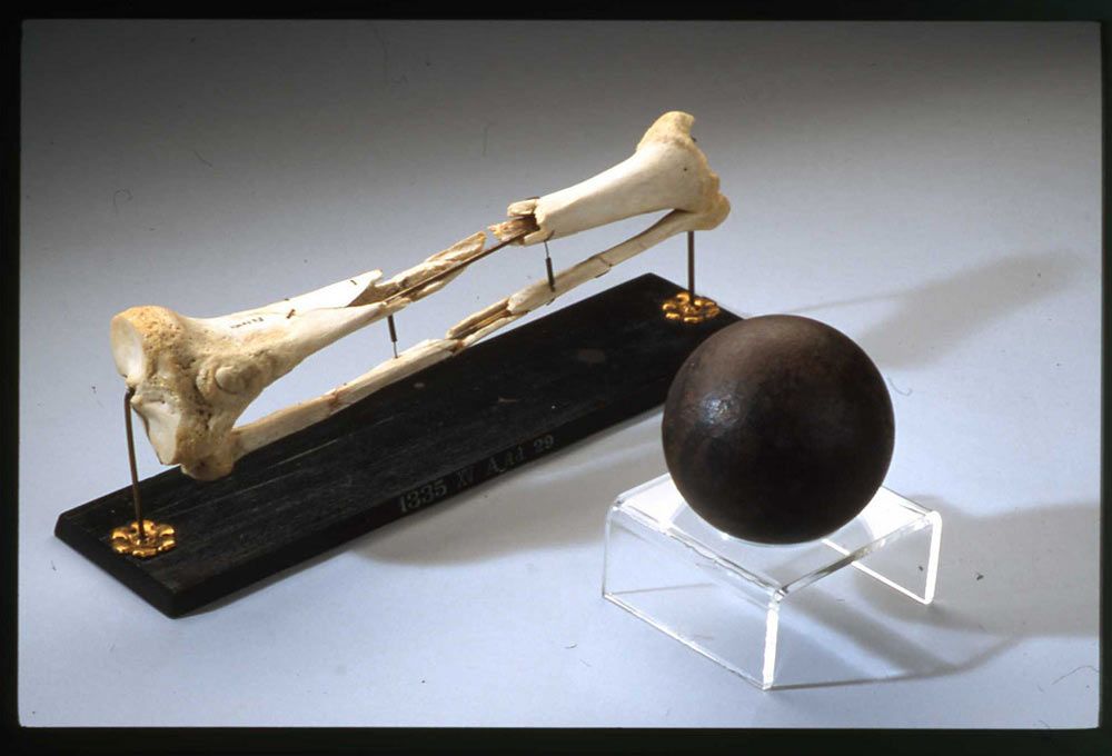 Album: Faces and Injuries of the Civil War | Live Science