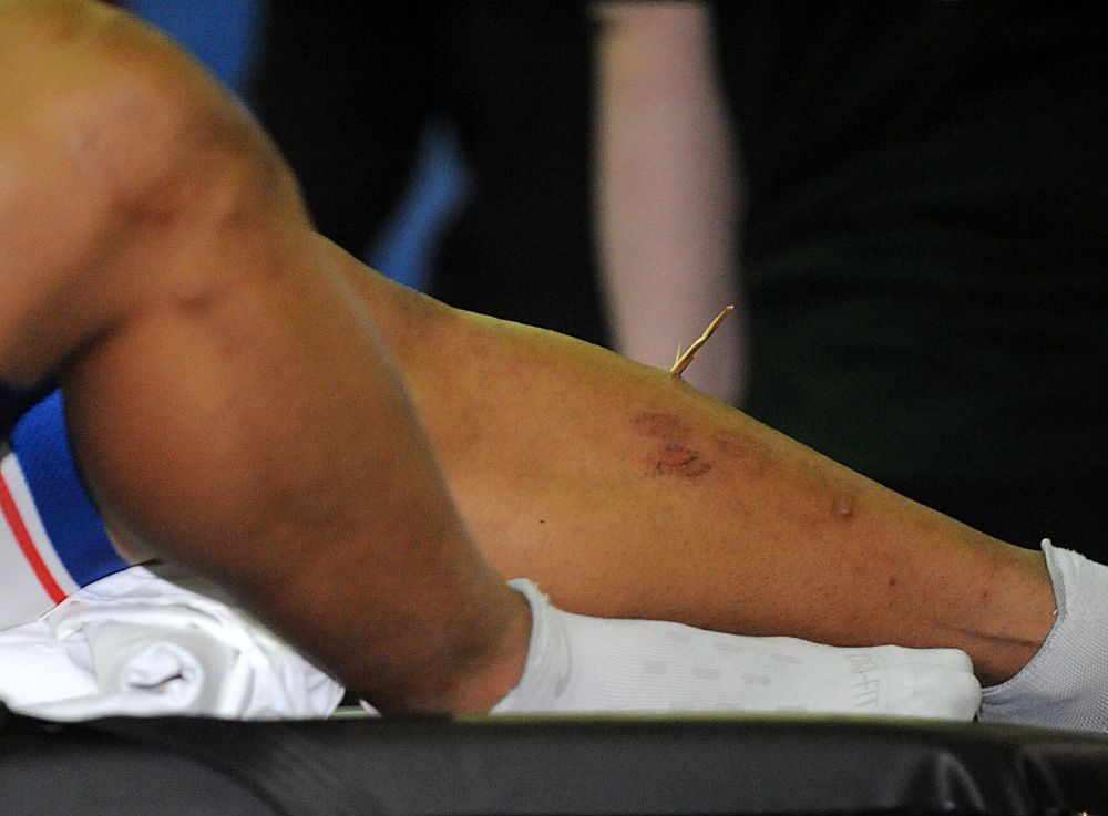 Awang needs surgery to remove huge splinter | Cycling Weekly