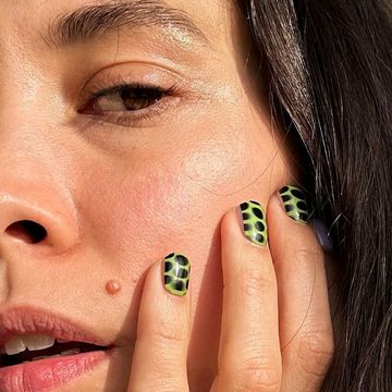 How to Pop a Pimple Safely: An Aesthetician’s Guide | Who What Wear