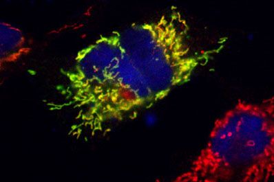 Cell Suicide: An Essential Part of Life | Live Science