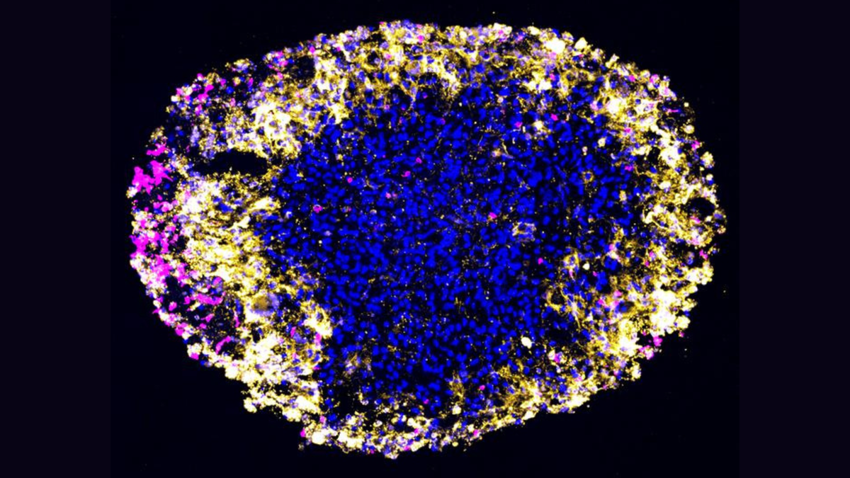 Body parts grown in the lab | Live Science