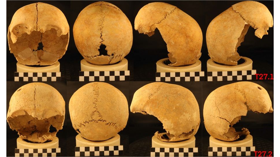 3rd-century-B.C. woman was buried facedown with a nail hole in her ...
