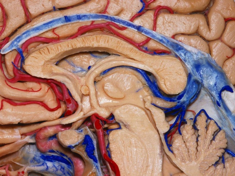 3D Images: Exploring the Human Brain | Live Science
