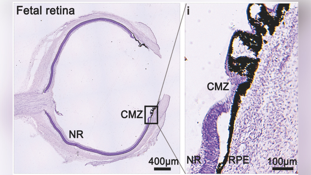 New cells discovered in eye could help restore vision, scientists say ...