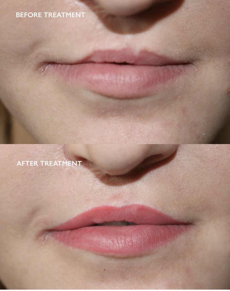 Permanent Make-up — Everything You Need To Know | Marie Claire UK