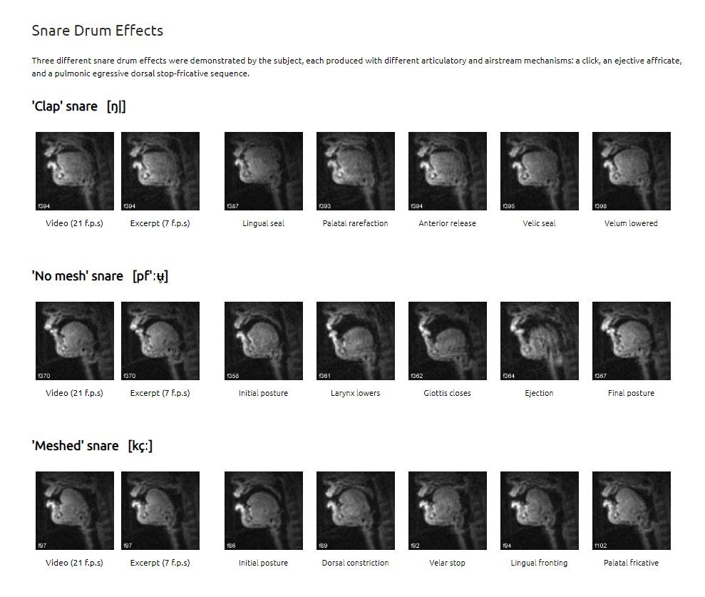 Watching People Beatbox in an MRI Machine Will Blow Your Mind | Live ...