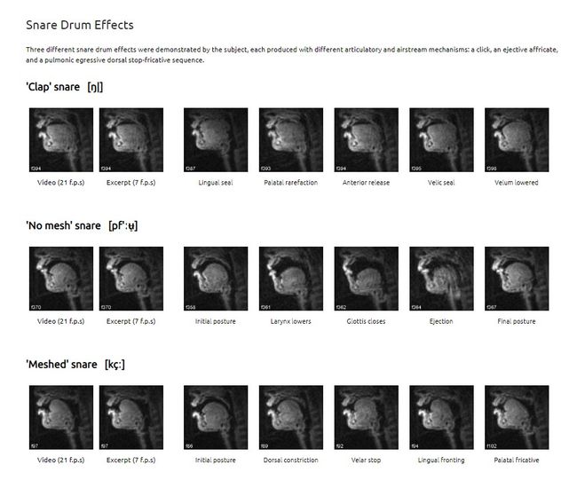 Watching People Beatbox in an MRI Machine Will Blow Your Mind | Live ...