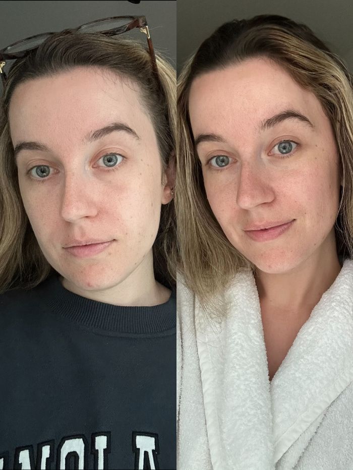 Dr Dennis Gross LED Mask, Honestly Reviewed | Who What Wear