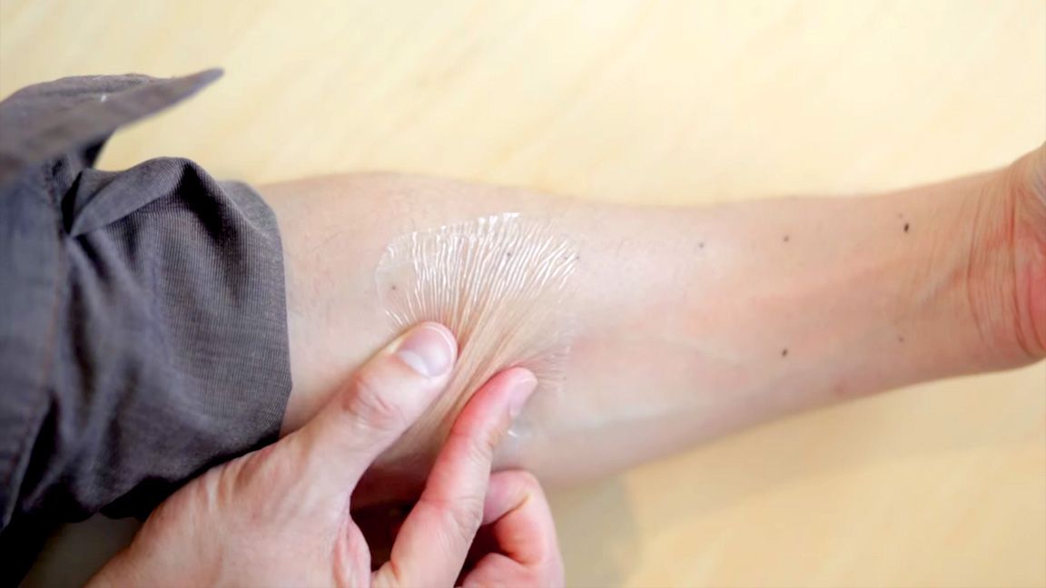 This super-stretchy material may be the future of skin treatments ...