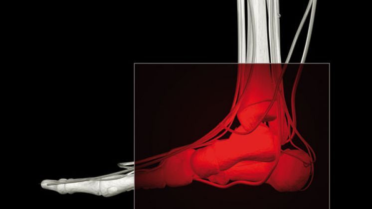Fix lower body injuries | Coach