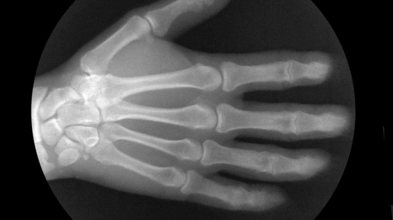 Animated X-rays reveal how your bones move | Creative Bloq