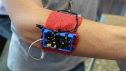 Bionic arm brings Intel's vision of personalized computing to life ...