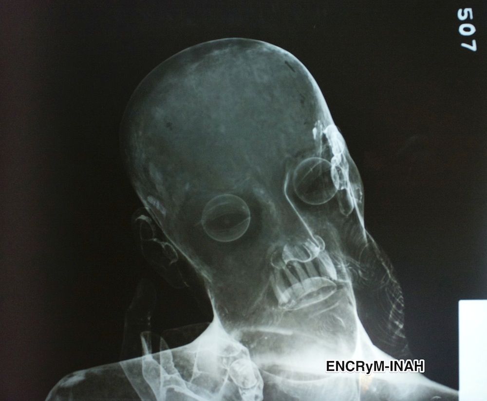 Jesus Chompers! Mexican Statue Has Real Human Teeth | Live Science