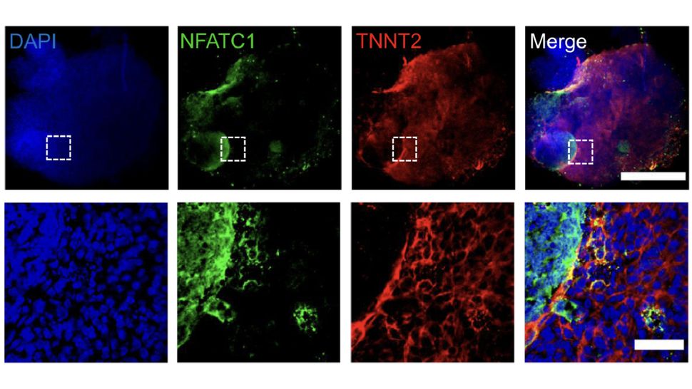 Body parts grown in the lab | Live Science