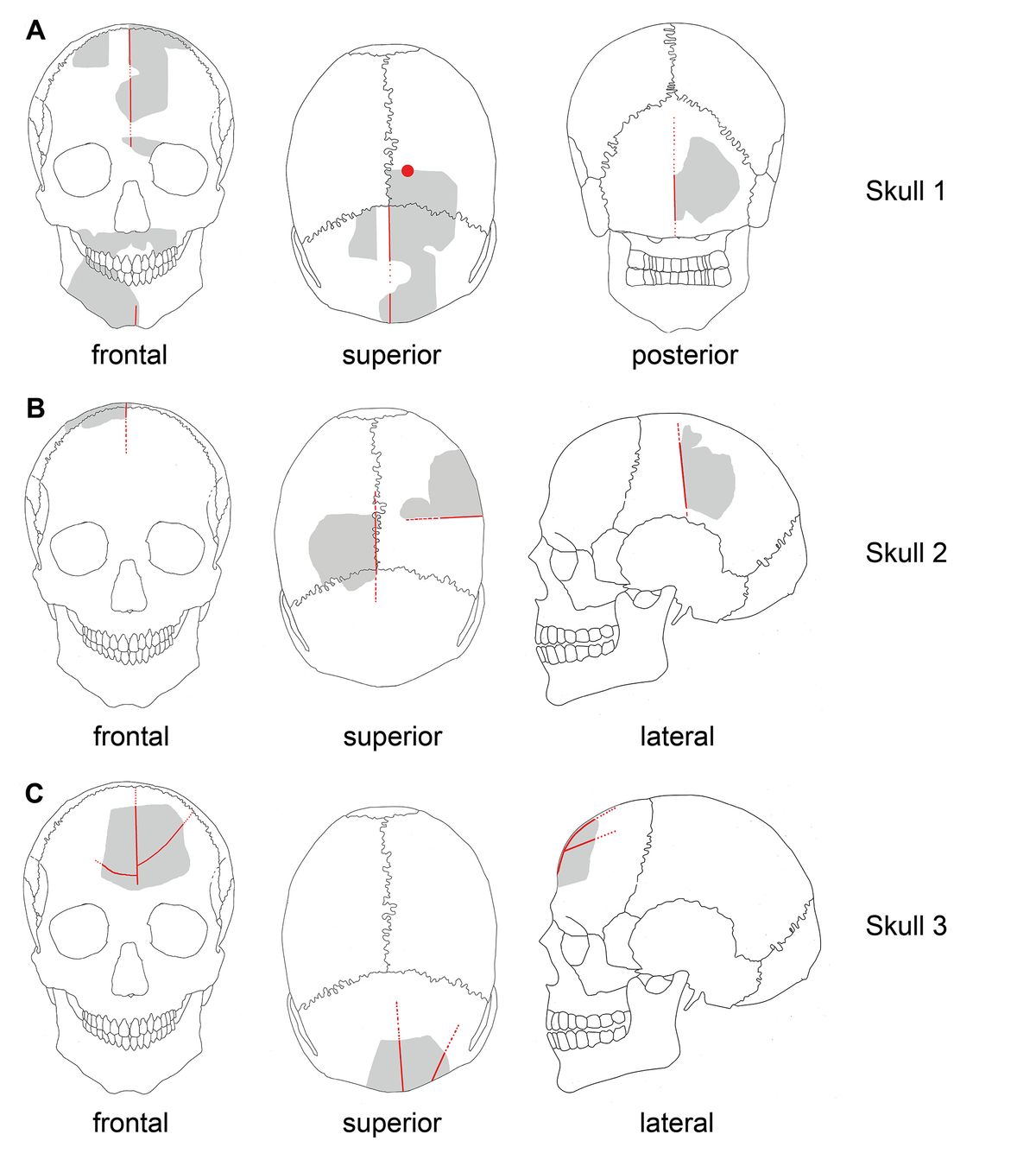 In Photos: Carved Human Skulls Discovered at Ritual Site | Live Science
