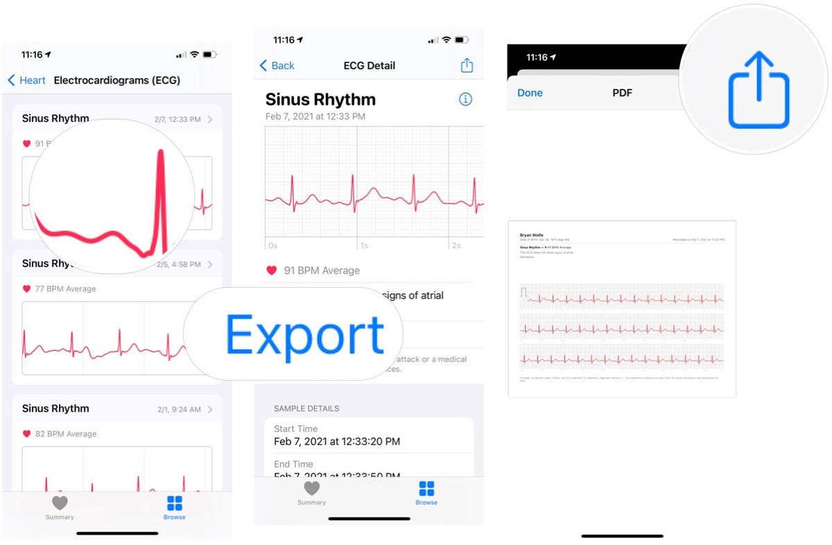 ECG Apple Watch App: The Ultimate Guide | iMore