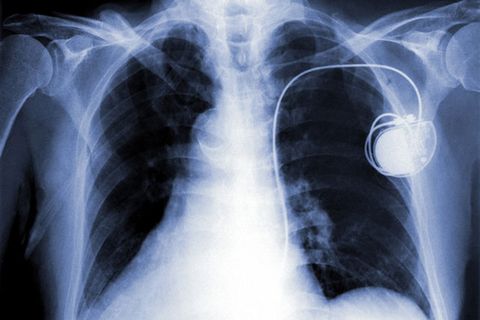 Heart Cells Transformed Into 'Biological Pacemaker' | Live Science