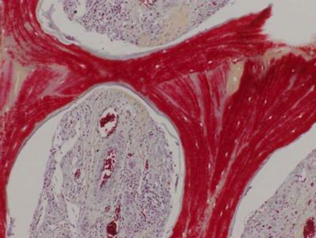 Lab-Grown 'Living' Bones Could Yield Customized Implants | Live Science