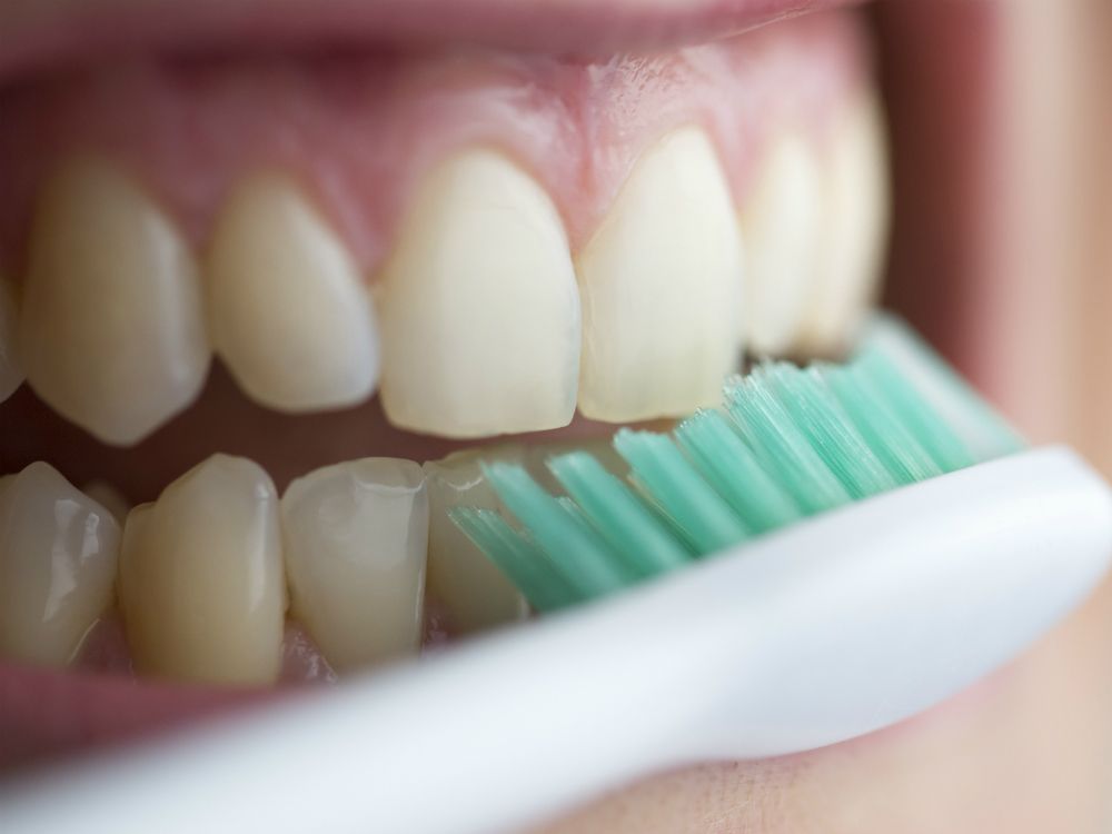 DIY Braces: How they work, how much they cost, plus are they safe ...