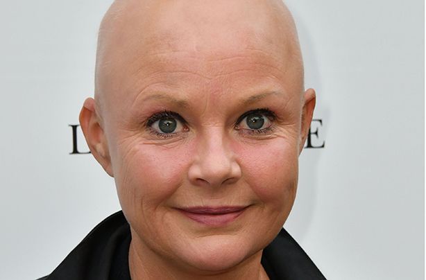 'The best thing I've ever done' - Gail Porter reveals breast reduction ...