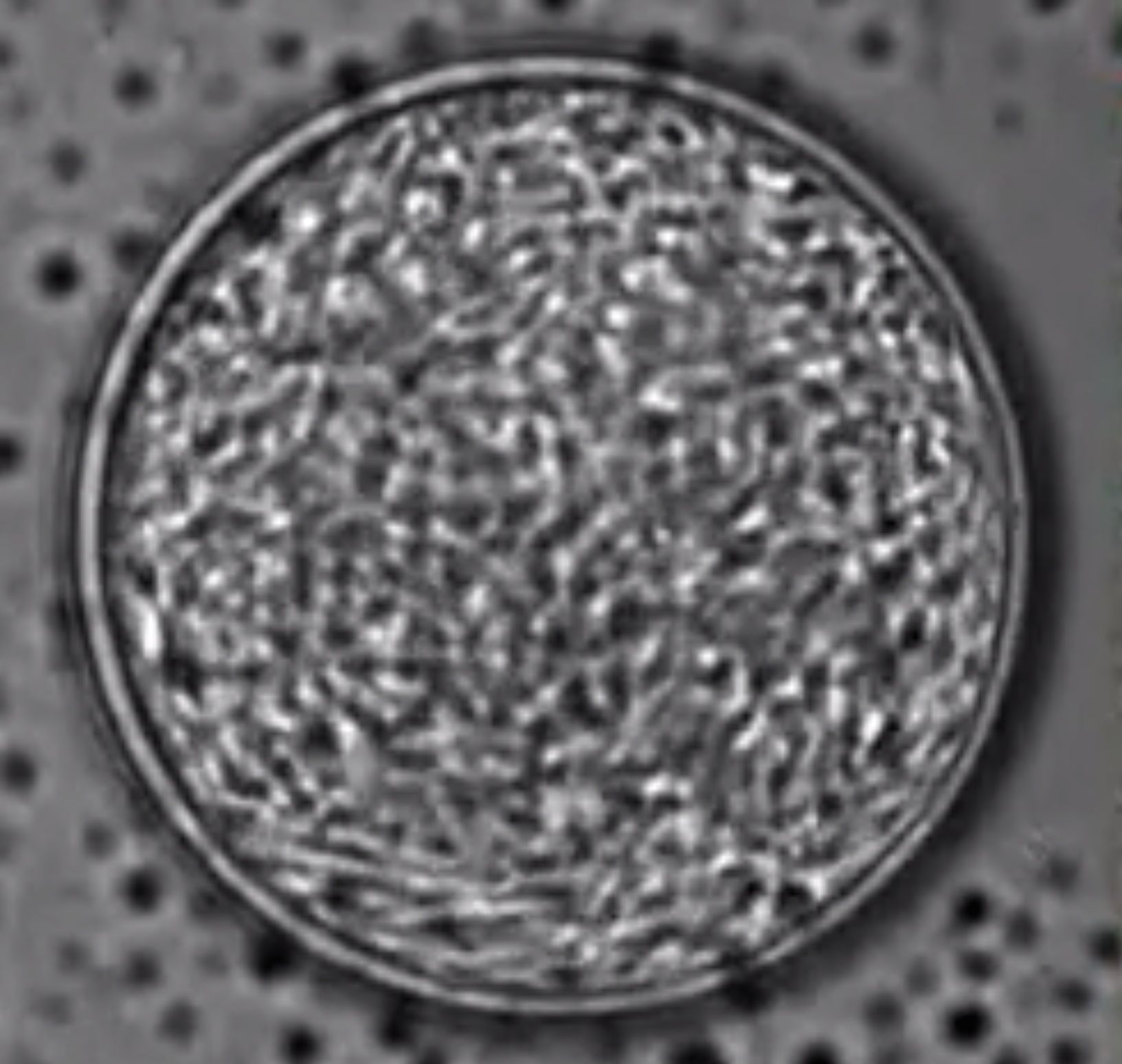 Bacterial Vortex: Microbes' Odd 'Swimming' Behavior Explained | Live ...