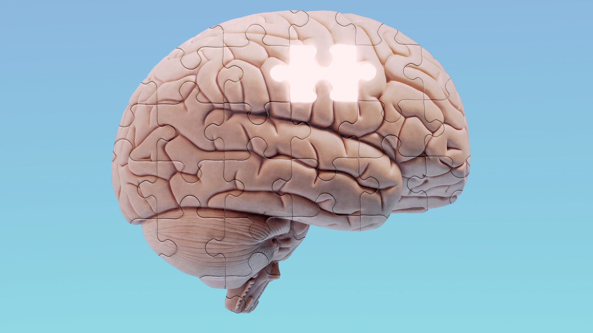 Can your brain run out of memory? | Live Science