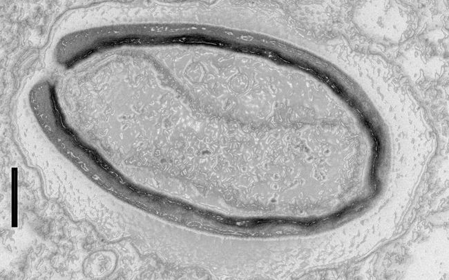 Giant Viruses Invent Genes Shared by No Life on Earth | Live Science