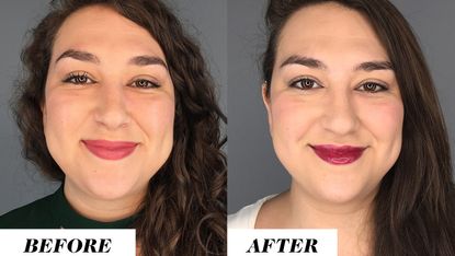 Does Drinking Water Help Your Skin - Facts on Drinking Water for Acne ...