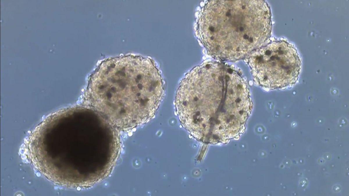 Scientists have 3D-printed heart and liver 'organoids' that could save ...