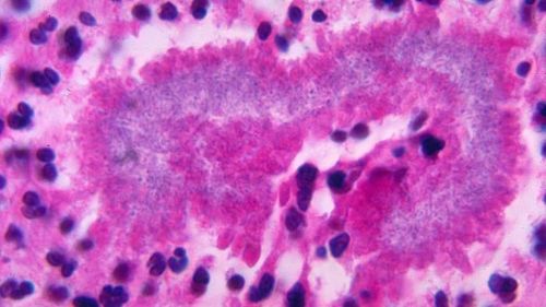 Tonsils: Definition, anatomy & function | Live Science