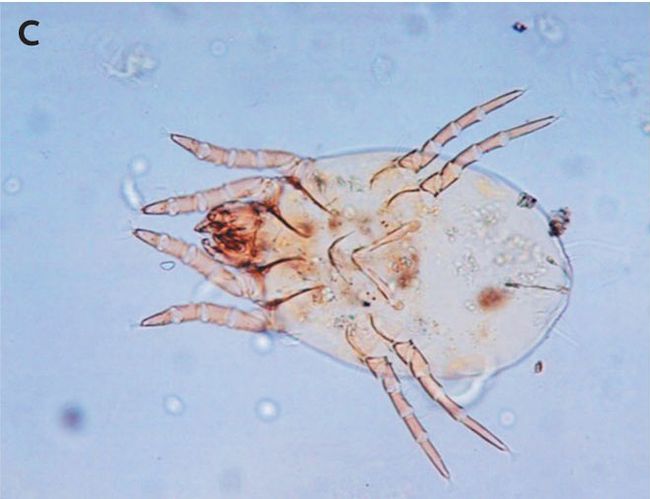 Ear Mites Case a Rarity, Report Finds | Live Science