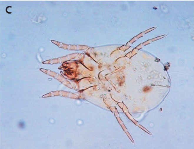 Ear Mites Case a Rarity, Report Finds | Live Science