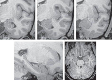 Criminal Minds Are Different From Yours, Brain Scans Reveal | Live Science